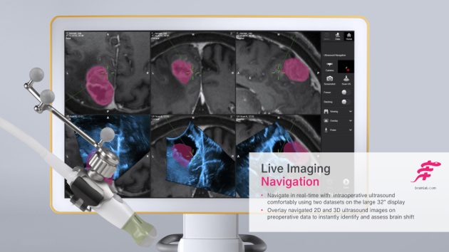 NAVIGATOR Innovation: Brain Surgery Navigation System - Enhancing ...