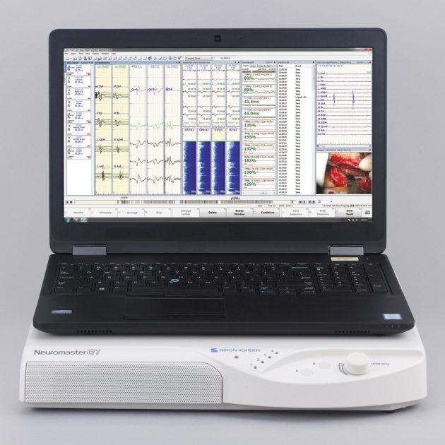 NAVIGATOR Innovation: Brain Surgery Navigation System - Enhancing ...